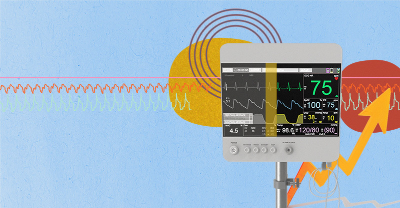 How to Monitor Signal Evolution in Key Interest Areas | ITONICS